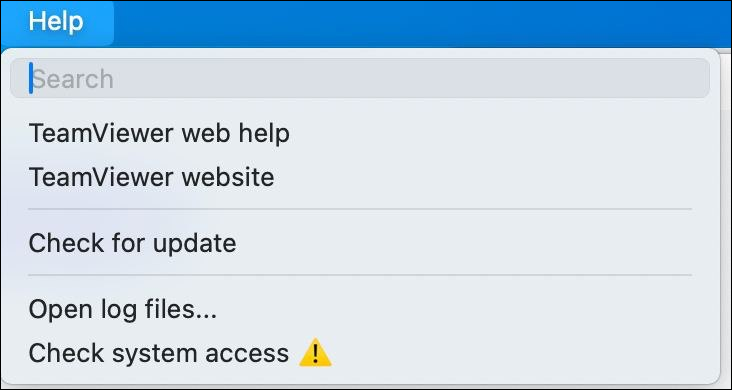 Remote installation with TeamViewer (MacOS) – EyeZy